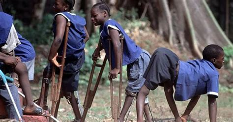 Todo Sobre La Polio Que Parecía Erradicada Principales Síntomas Y Causas