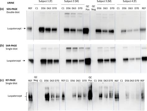 Detection Of Erythropoiesis Stimulating Agent Luspatercept After