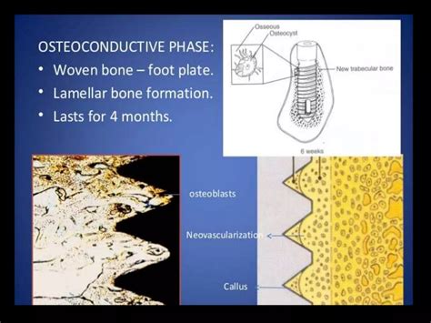 Osseointegration Pptx Dental Health Diseases And Conditions