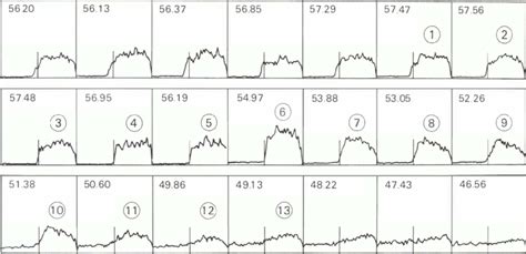 Reflected Radar Pulses Obtained By The Seasat Altimeter As It Download Scientific Diagram