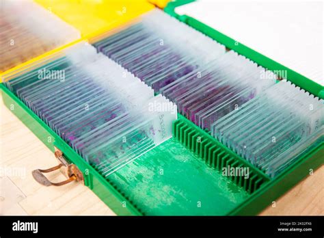 Box Of Stained Tissue Biopsy Glass Slides In Pathology Laboratory Stock