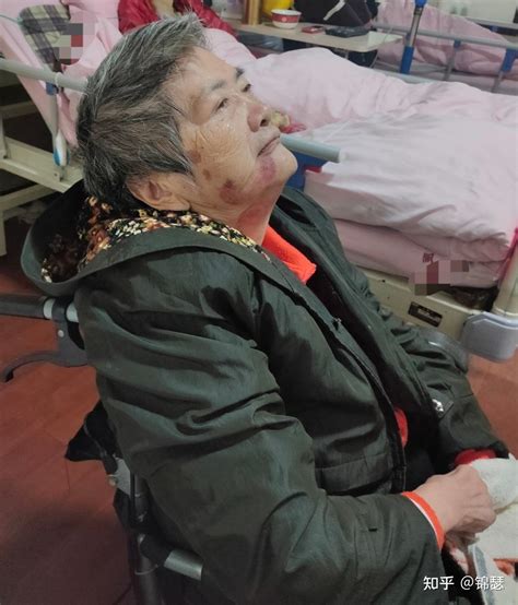 专治流口水 知乎