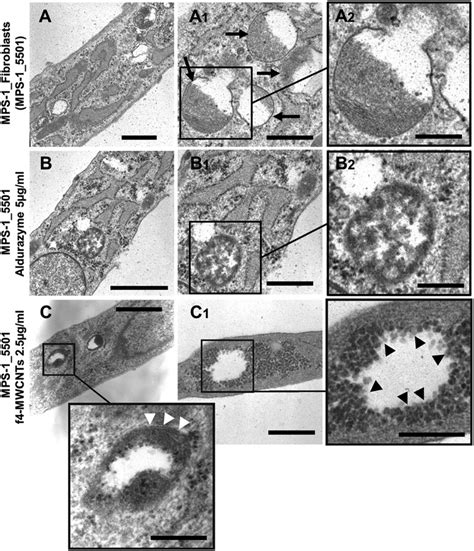 Transmission Electron Microscopy Images Showing The Morphology Of