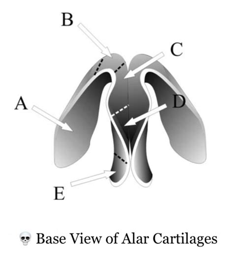 Yousef Nazari On Linkedin 💀 Base View Of Alar Cartilages A Lateral