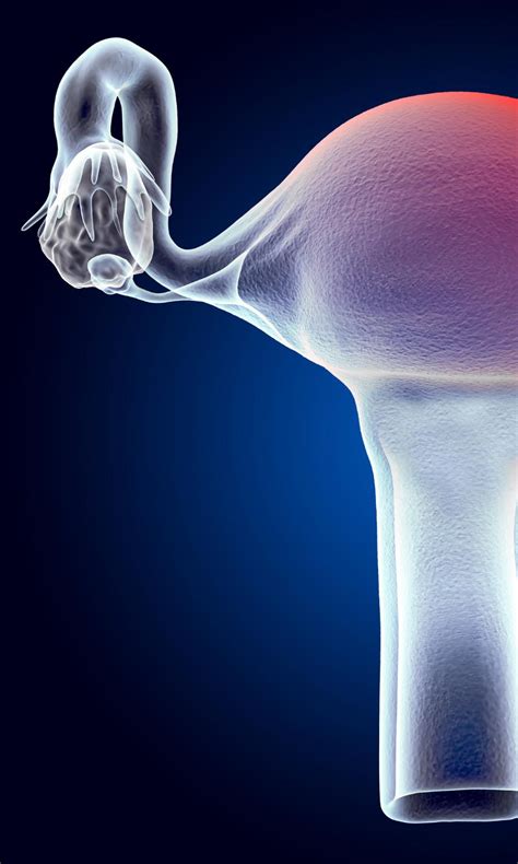 Do Fibroids Affect Pregnancy Usa Fibroid Centers