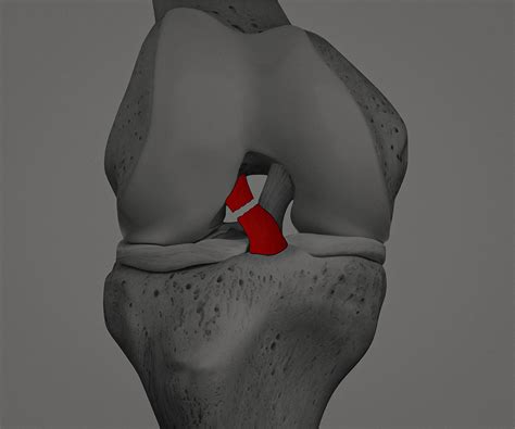 LesÃo No Ligamento Cruzado Anterior Causas Sintomas E Tratamentos