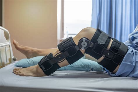 ‘breakthrough Treatment For Acl Tears Allows Tendon To Heal Instead Of Being Rebuilt Wtop News