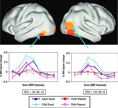 Five Bilateral Extrastriate Cortex Regions Showing Both Significant