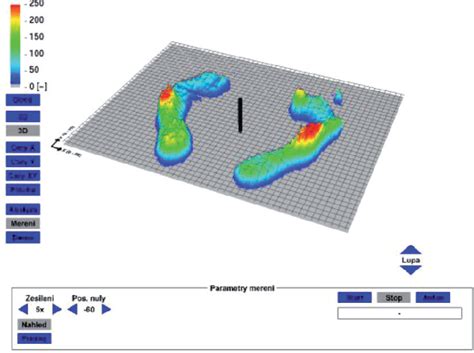 Figure 3 From Properties Of Tactile Sensors Based On Resistive Ink And