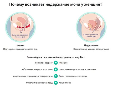 «СТОПИНОР» от недержания мочи у женщин и мужчин – реальные отзывы, цена ...