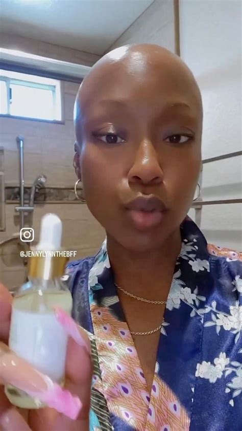 Baldare Baldie Scalpcare On Instagram Jennylynnthebff Said What