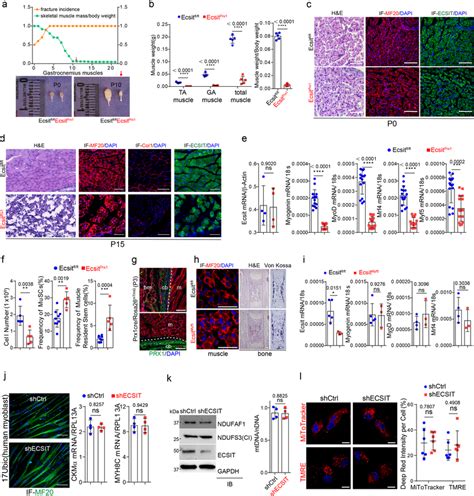 Ecsitprx1 Mice Display Skeletal Muscle Atrophy A Graph Shows The