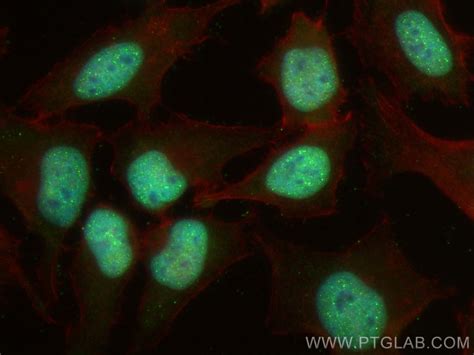 Histone H3 Antibody 17168 1 Ap Proteintech 武汉三鹰生物技术有限公司
