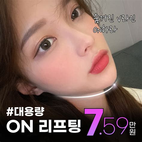 대용량 On 리프팅 주사 By 온리프성형외과의원 강남언니 1등 성형수술and피부시술 정보앱