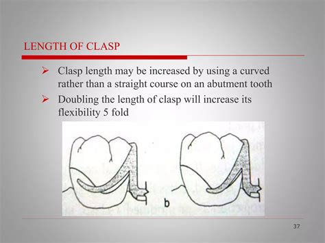 Designing For Kennedy Class I And Class Ii Ppt