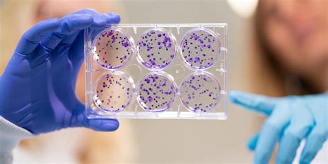 Potential New Drug Combination For Er Positive Breast Cancer Breast