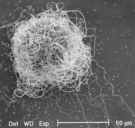 Semen Under Microscope