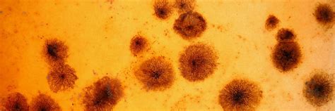 Microbes Under Microscope Background Images Hd Pictures And Wallpaper