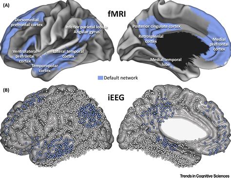 Intracranial Electrophysiology