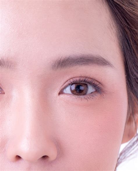 Glaucoma Treatment In Houston Tx Eye Center Of Texas