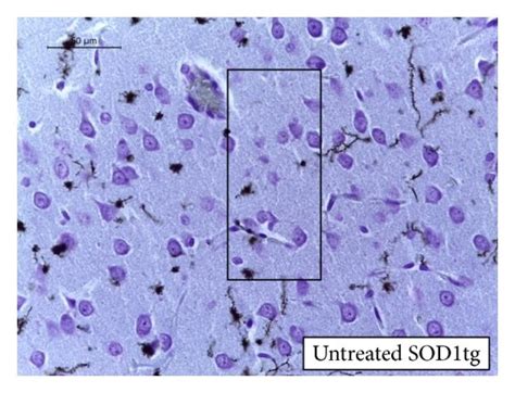 Cleaved Caspase3 Activation And Dendritic Spine Detection Western Blot