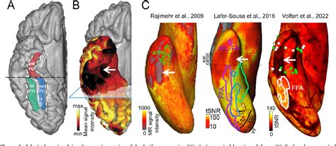 Figure 2 From The Anterior Fusiform Gyrus The Ghost In The Cortical Face Machine Semantic Scholar