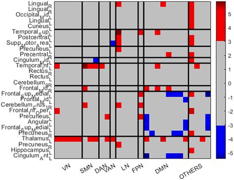Abnormal Degree Centrality And Functional Connectivity In Down Syndrome A Resting State Fmri