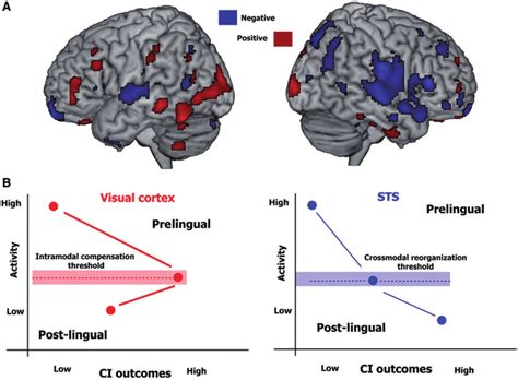 Model Of Crossmodal Reorganization And Auditory Recovery A Download Scientific Diagram