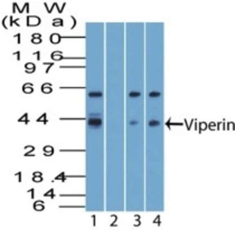 Setd8 Antibody Bsa Free Novus Biologicals 0025mg Unlabeled