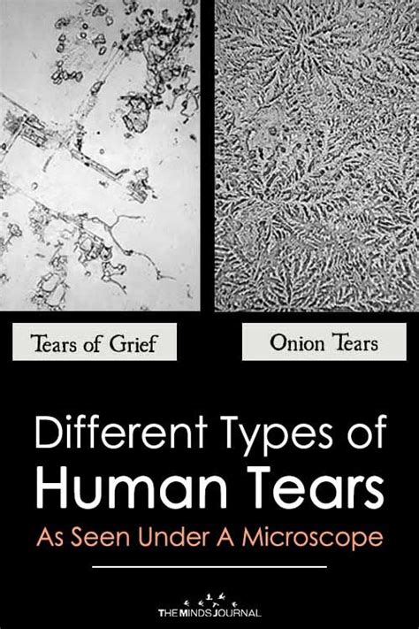Three Different Types Of Human Tears As Seen Under Microscopes With