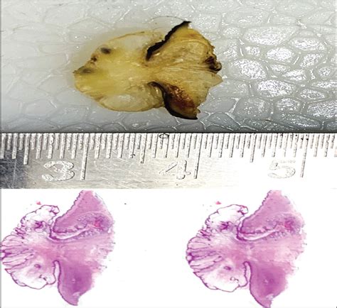 International Journal Of Trichology