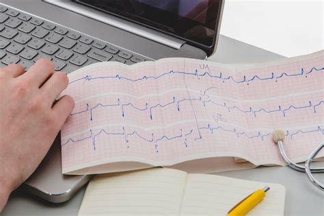 Resting ECG HKCDC Hong Kong Cardiac Diagnostic Centre