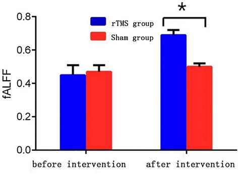 Showing The Between Group Difference In Falff Within The Dmn Before