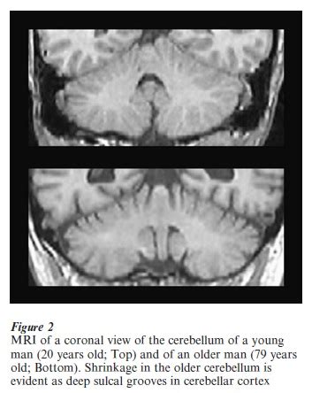 Neural Basis Of Memory And Aging Research Paper IResearchNet