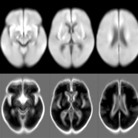 Radiological Normal Dwi Templates A Average And B Standard