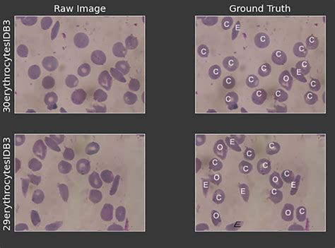 Raw Image And Ground Truth Label Download Scientific Diagram