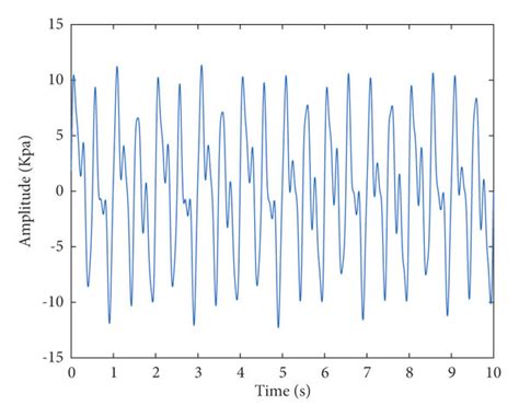 A Waveform Diagram And B Spectrogram After Lmd Pe Svd Noise