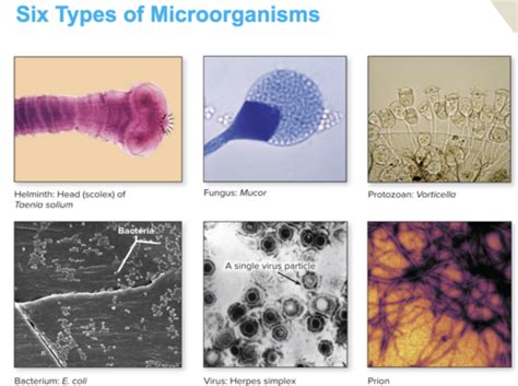 Chapter 1 Microbiology Chapter 2 Microbiology Chapter 3 Microbiology