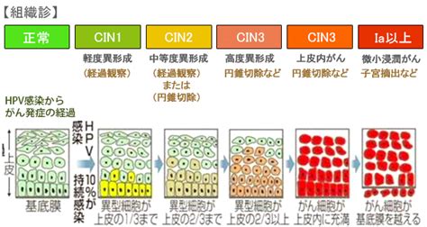 関西ウーマン