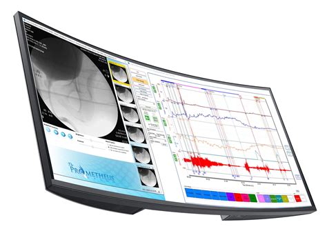 Pathway® Stm 10 Vaginal And Rectal Intracavity Stimulator The Prometheus Group®