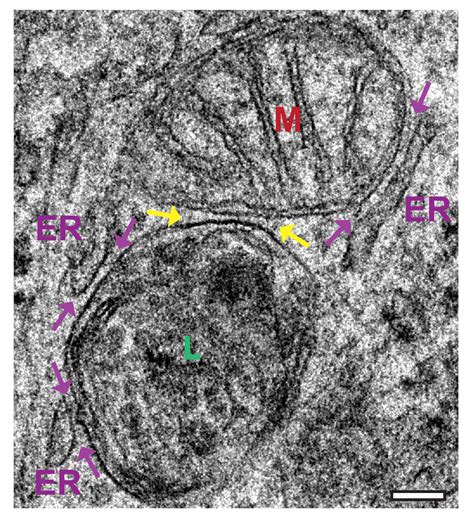 Scientists Identify Direct Contact Between Mitochondria And Lysosomes