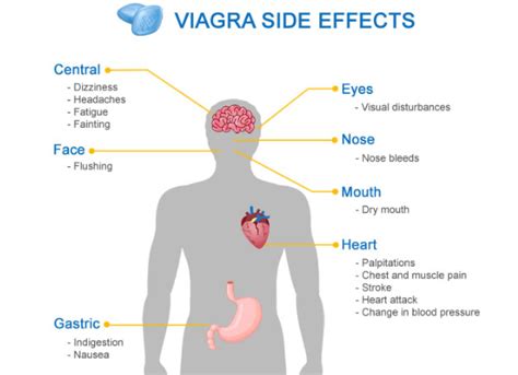 Viagra Side Effects Dr Sam Robbins