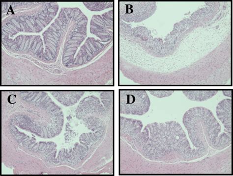 Representative Photomicrographs Of Hematoxylin And Eosin Stained
