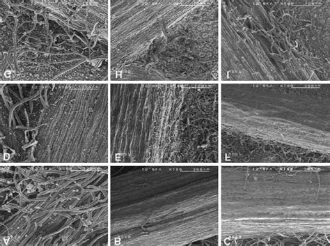 Sem Micrographs Of Midrib In Quercus Sect Quercus Q Macranthera A