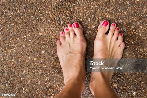 여름 날에 야외에서 포장도 서 있는 백인 여자의 왼쪽된 다리의 발등에 변형된 뼈를 제거 하는 아저씨 수술에서 회복 후 빨간색