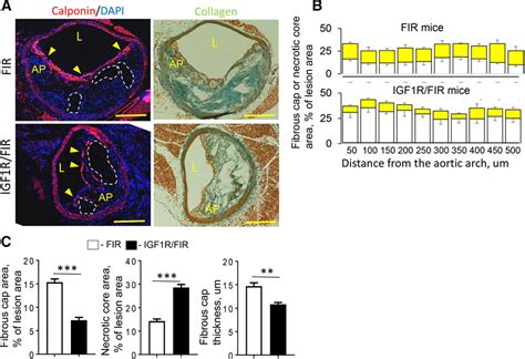 Sm22α Smooth Muscle Protein 22 α Promoter Driven Igf1r Insulin Like