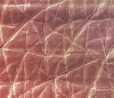 Skin Surface Sem Stock Image C0043588 Science Photo Library