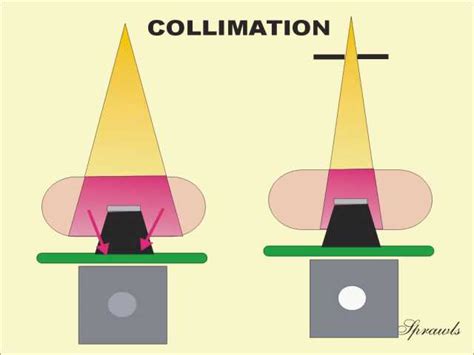 Radiography At Emaze Presentation