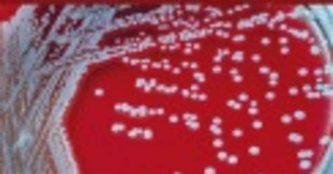 Staphylococcus Aureus—a Foodborne Pathogen Epidemiology Detection