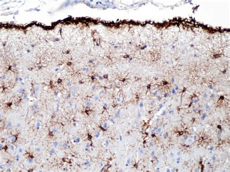 Immunohistochemical Staining Techniques Histology Uwmadison